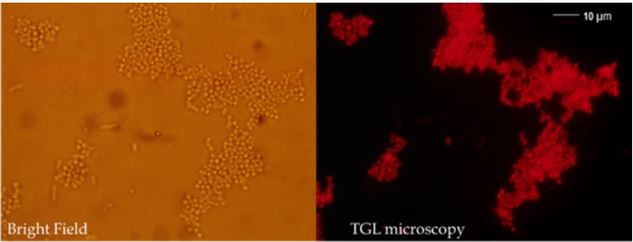 Illuminating the golden staph | Australian Research Council